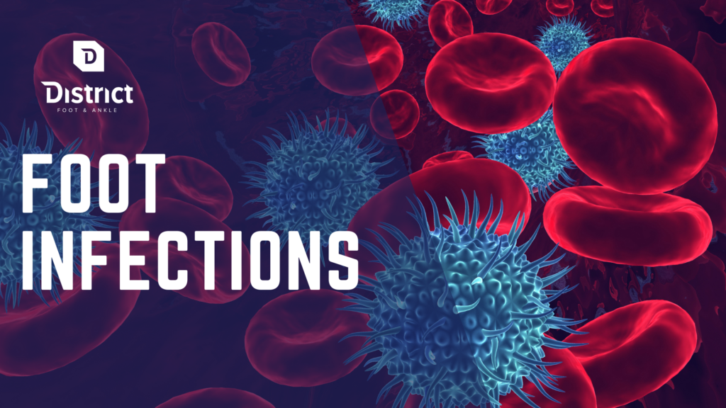 Foot Infections: Symptoms, Risk Factors, and Treatment Options ...