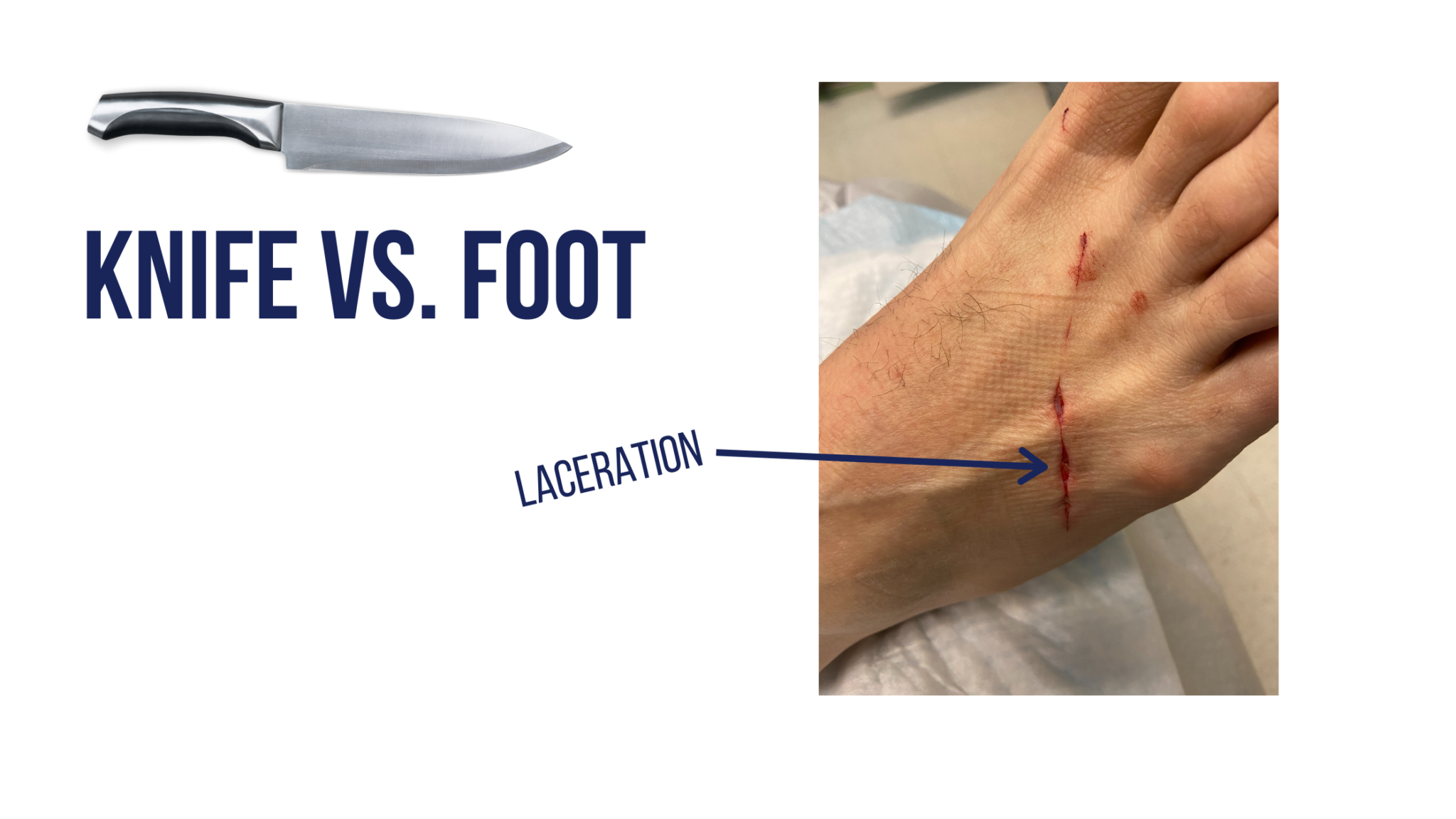 We treat tendon injuries and lacerations at District Foot and Ankle ...