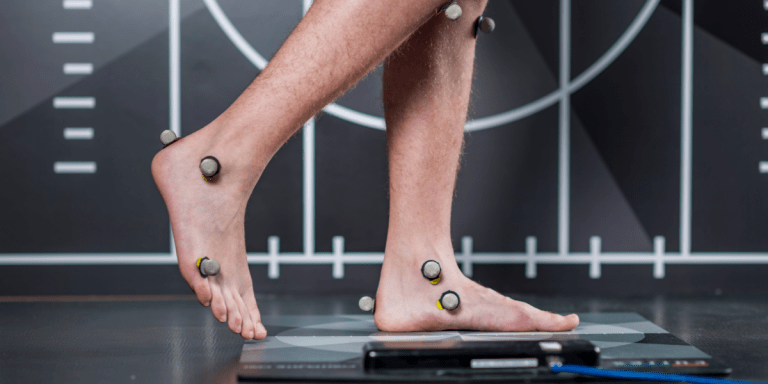 What Is Gait Analysis and How It Helps You Live Pain-Free