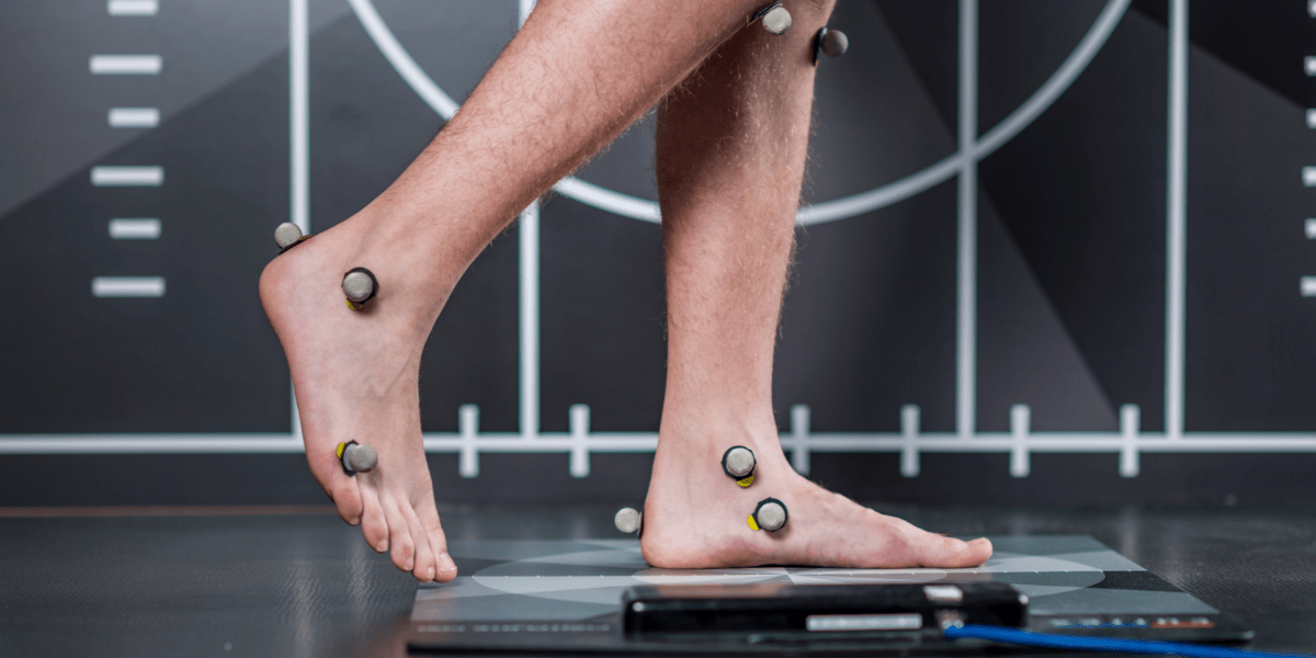 What Is Gait Analysis and How It Helps You Live Pain-Free